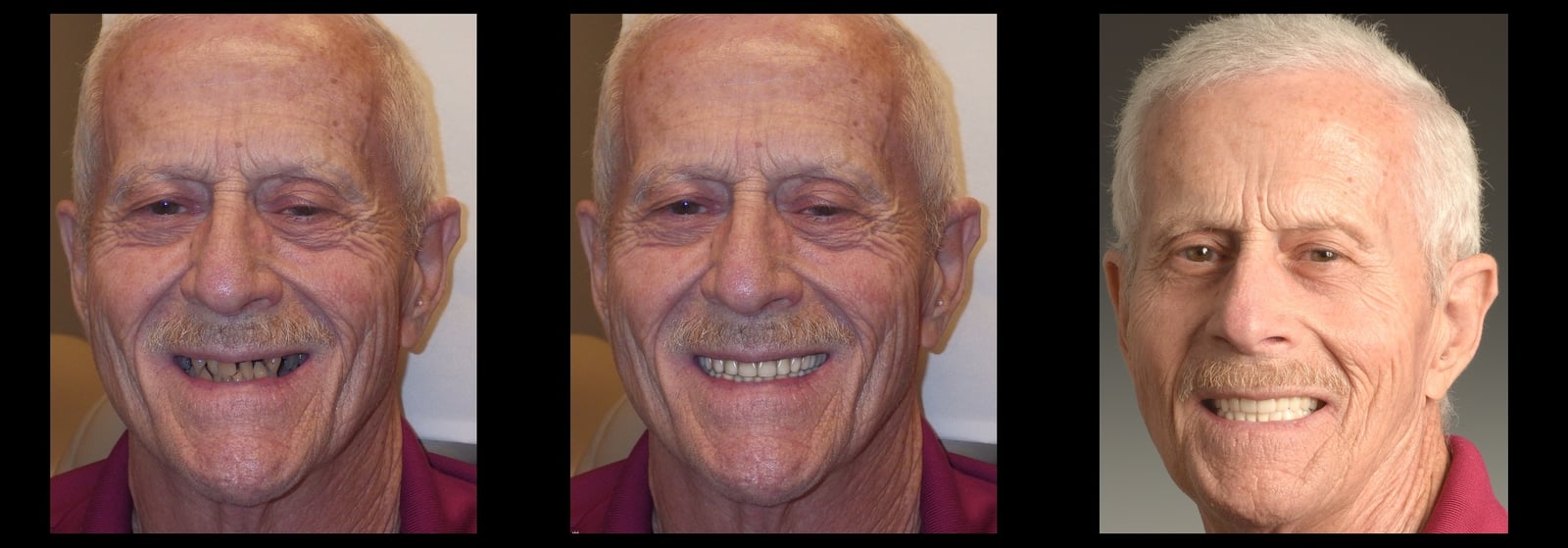 Smile Gallery | William Linger, DDS, MAGD