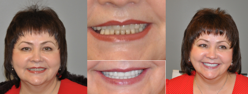 Smile Gallery | William Linger, DDS, MAGD