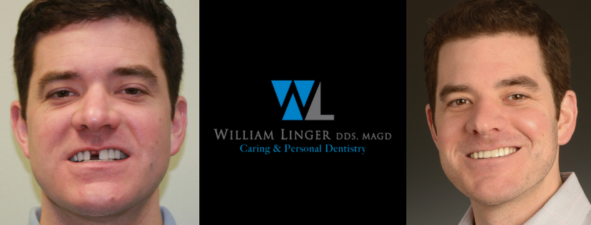 Smile Gallery | William Linger, DDS, MAGD