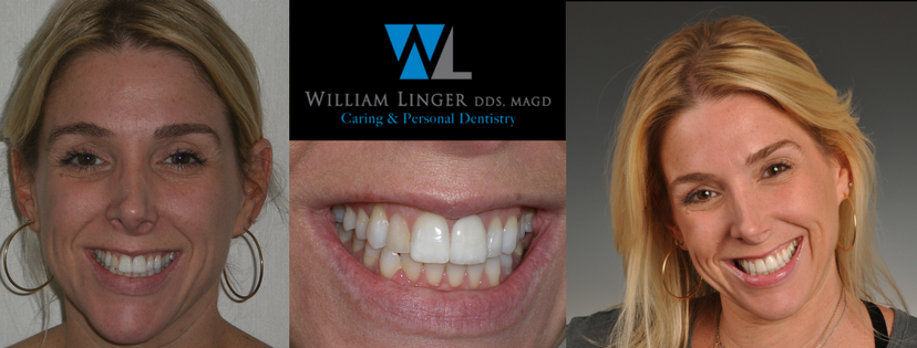 Smile Gallery | William Linger, DDS, MAGD