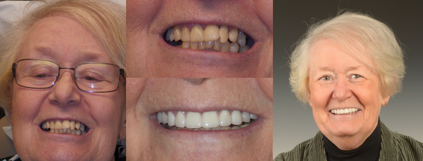 Smile Gallery | William Linger, DDS, MAGD