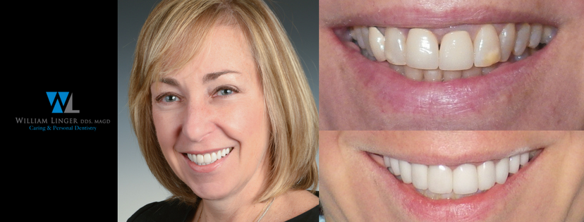 Smile Gallery | William Linger, DDS, MAGD