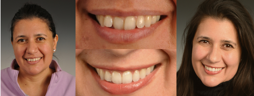 Smile Gallery | William Linger, DDS, MAGD