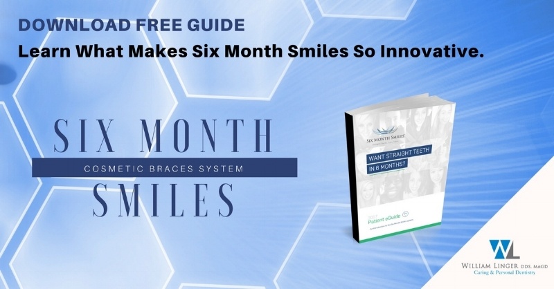 What is a Six Month Smile?